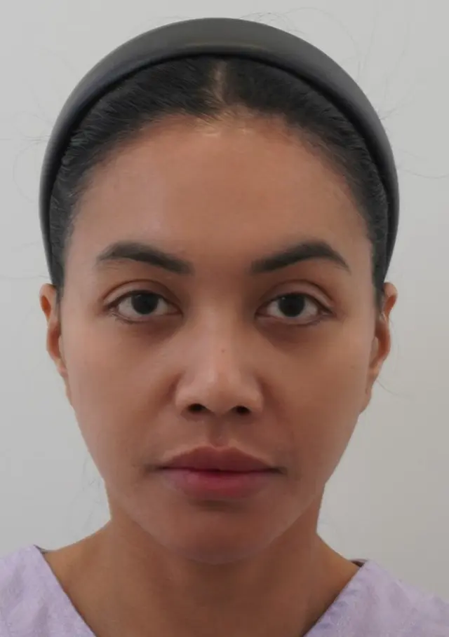 Wajah Denada Usai Operasi Plastik Bikin Pangling, Lihat Perbedaannya ...