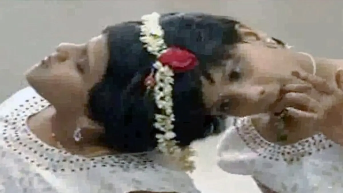 Berita kembar siam parasit Hari Ini - Kabar Terbaru Terkini | Liputan6.com