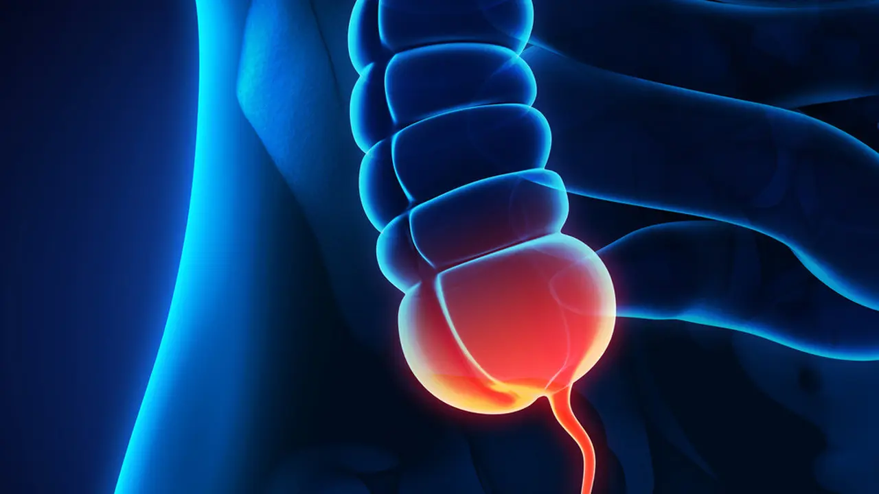 8 Ciri Usus Buntu dan Letaknya yang Mirip Penyakit Lain, Cegah Sejak ...