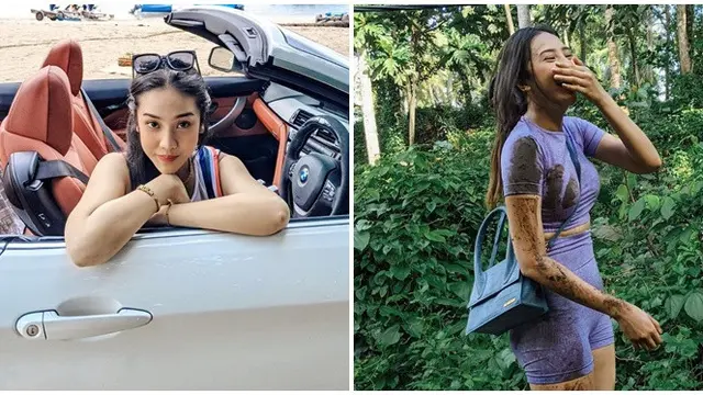 6 Momen Anya Geraldine Liburan di Bali, Alami Luka karena Jatuh dari Sepeda - Hot Liputan6.com