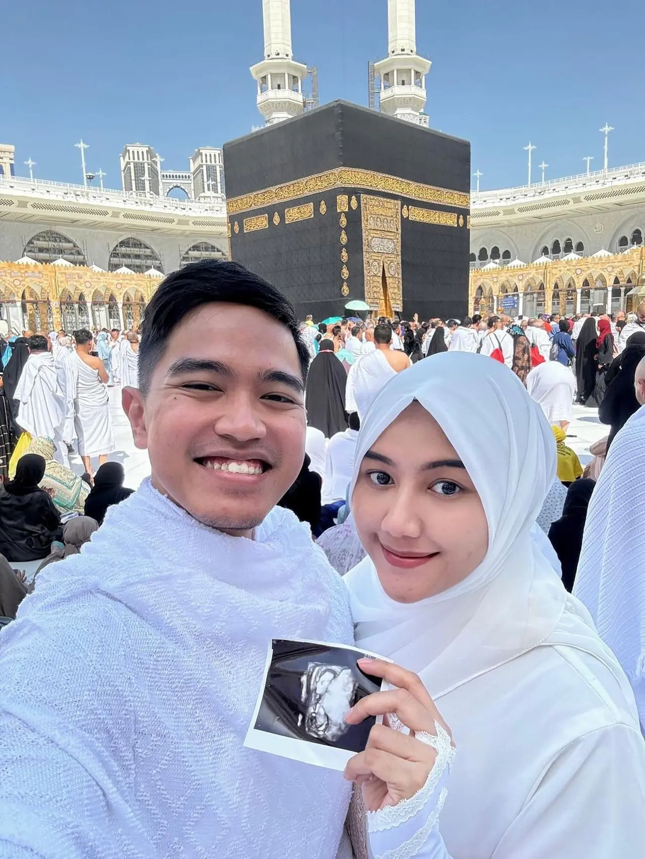 Kaesang Pangarep Umumkan Erina Gudono Hamil Trimester 2, Pamer Foto Hasil USG di Dekat Kabah ...