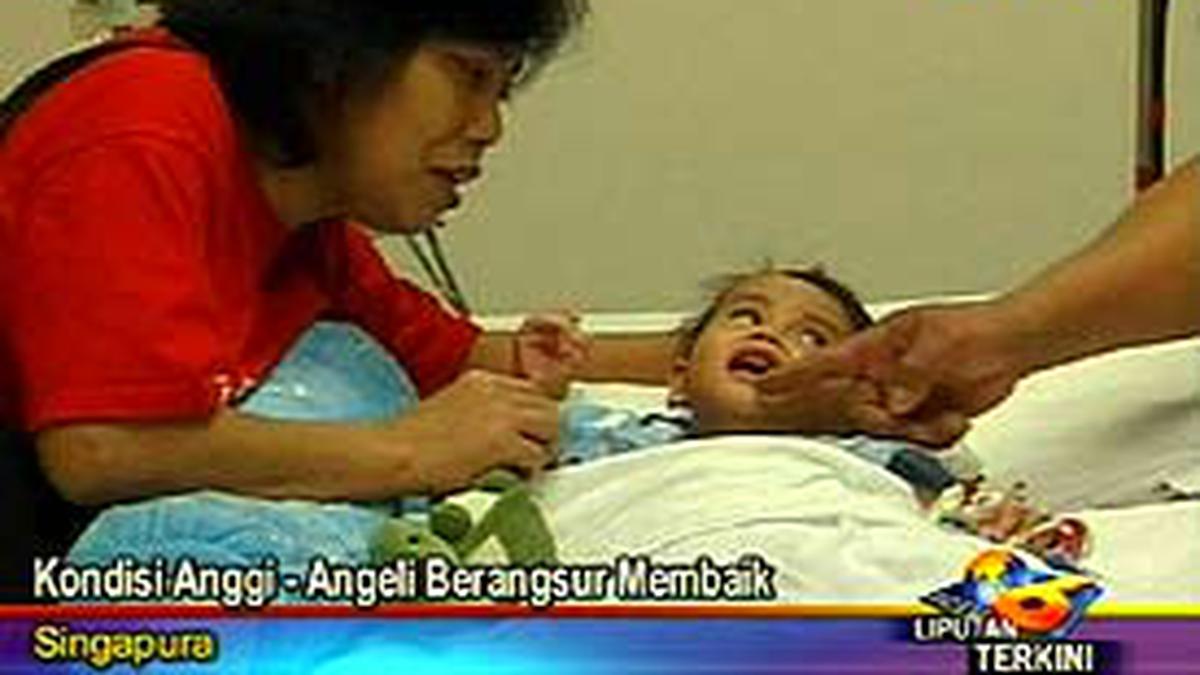 Kondisi Anggi-Angeli Stabil - News Liputan6.com