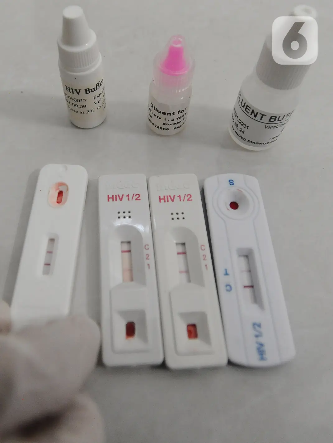 Kegiatan VCT Mobile Cegah Penularan HIV/AIDS di Kalangan Mahasiswa ...