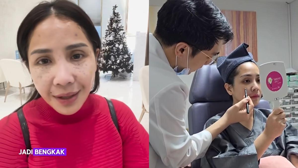 Malu Pulang ke Jakarta, Ini 7 Potret Wajah Bengkak Nagita Slavina di ...