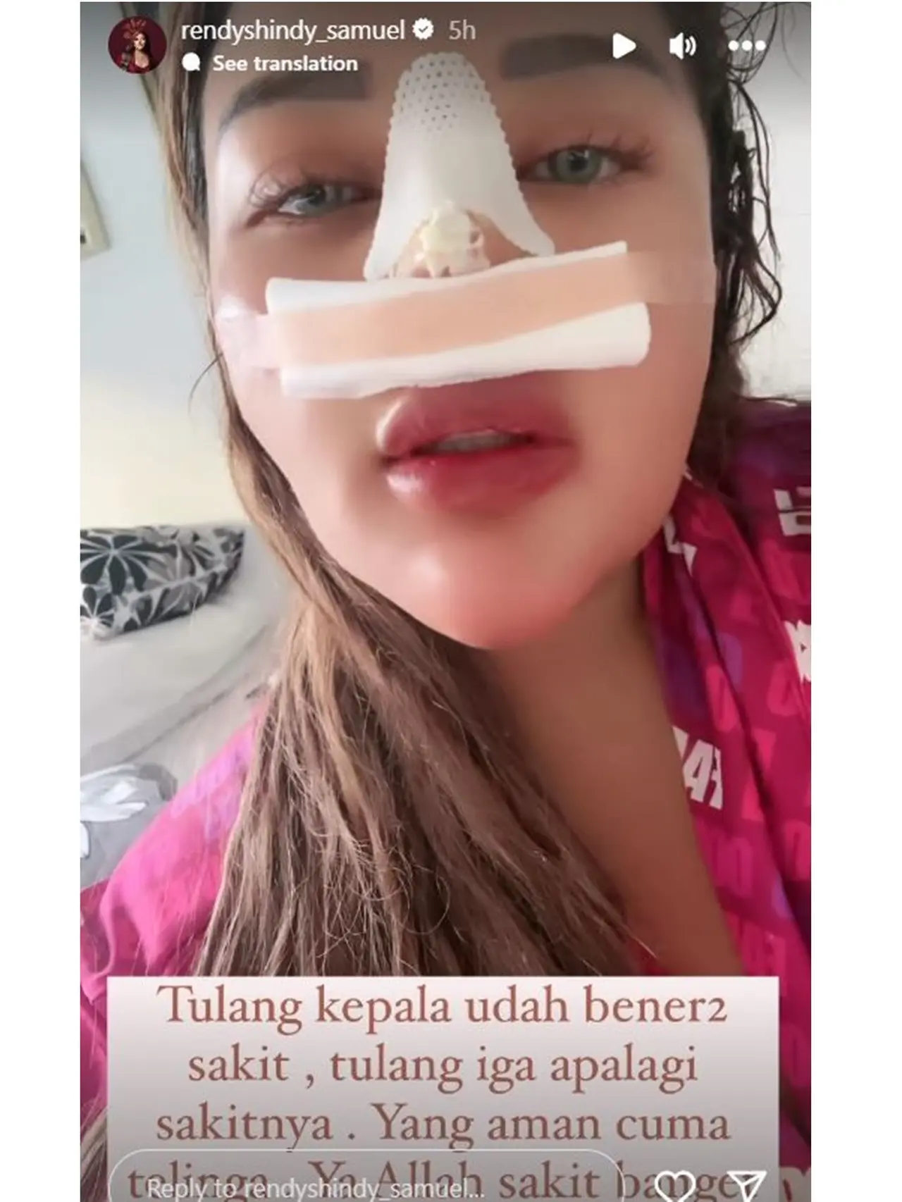 Setelah Operasi Bariatrik, Ini 6 Potret Shindy Samuel yang Kini Jajal Oplas Hidung - Hot ...