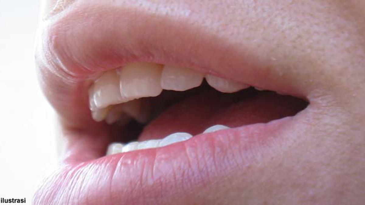 Sebelum Bibir Bergerak, Pria Ini Sudah Bisa Dengar Suara - Health ...