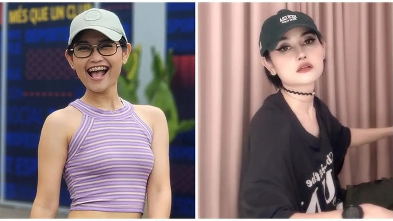 6 Potret Riyuka Bunga Sebelum dan Sesudah Oplas Hidung, Dulu Dipanggil ...