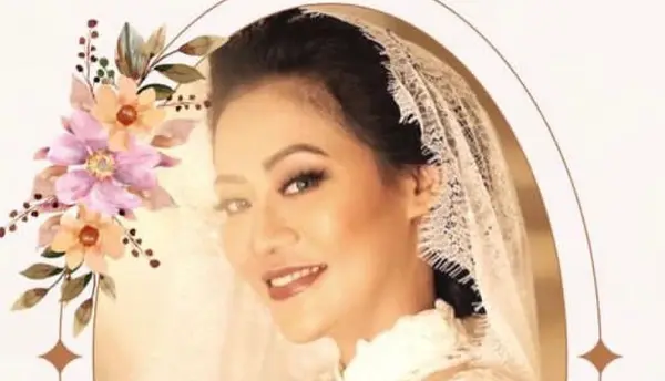 Karier Hancur, Penyanyi Dyna Fransisca Lakukan Operasi Plastik ...