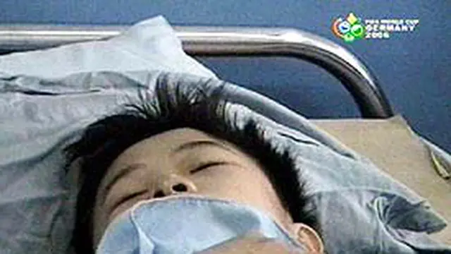 Kaki Kanan Rifki Saputra Akhirnya Diamputasi - News Liputan6.com