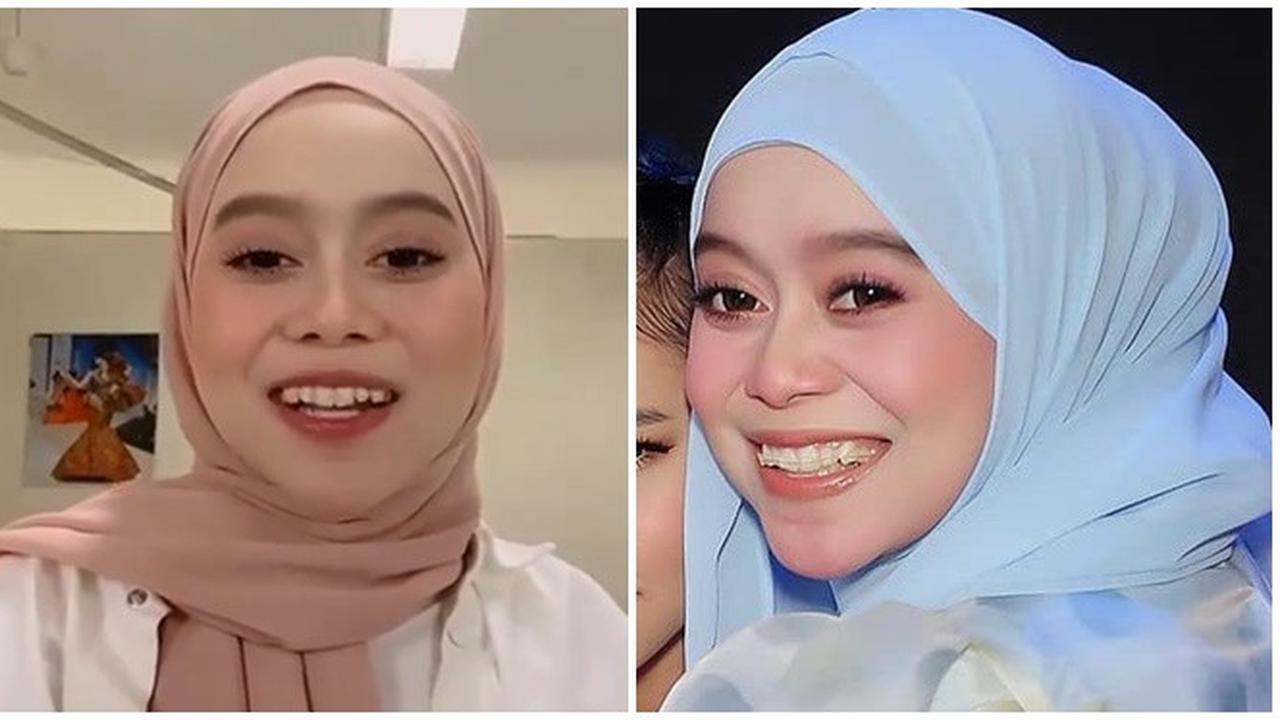 Hilangkan Gingsul, Ini 6 Potret Terbaru Lesty Kejora Tampil Pakai Behel