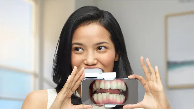 OneSmile Aligners Gunakan Artificial Intelligence untuk Maksimalkan ...