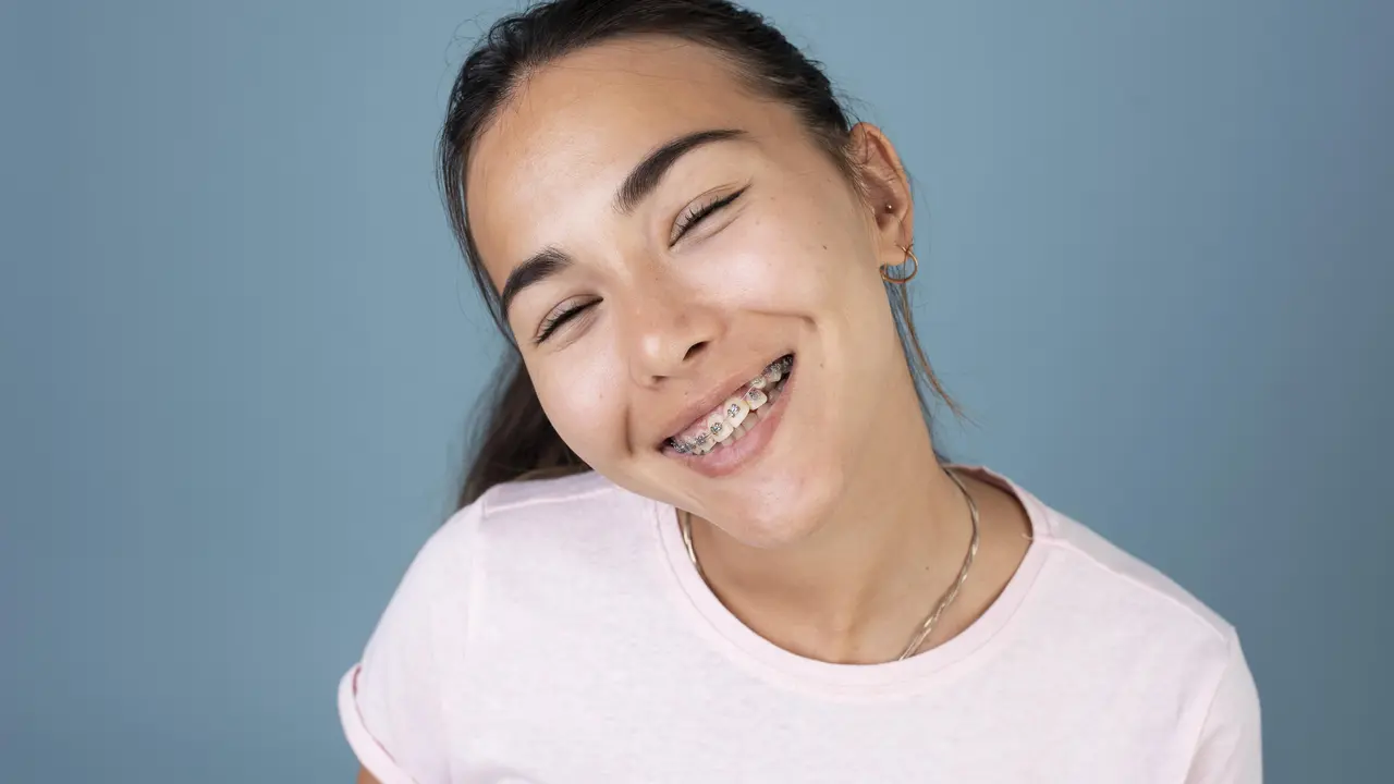 Mengenal Gigi Overbite dan Cara Mengatasinya - Health Fimela.com