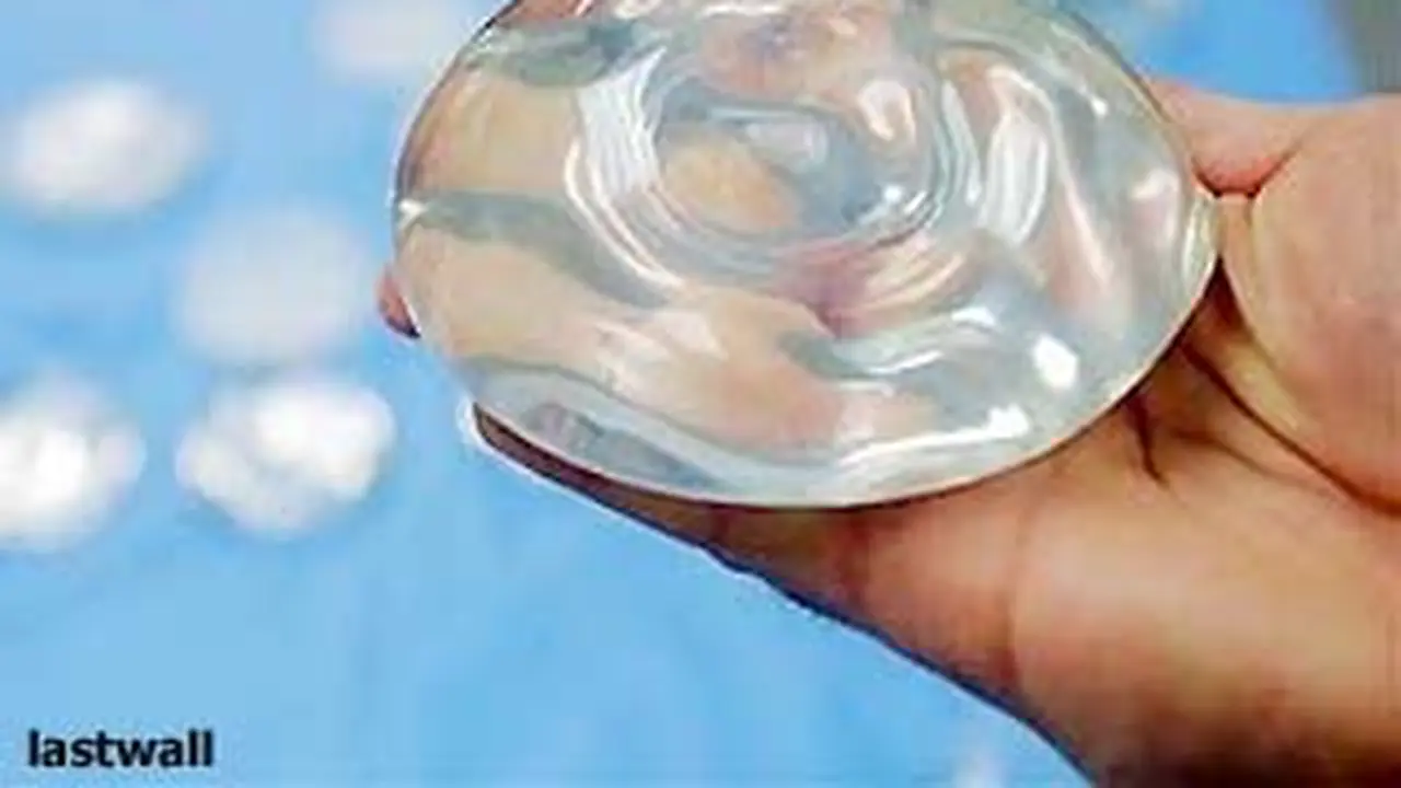 Kecanduan Silikon, Bokong Jadi Menggelembung - Health Liputan6.com