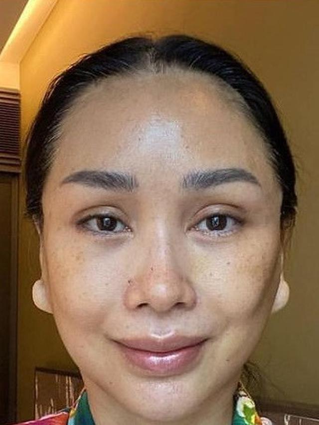 6 Potret Transformasi Titi DJ Usai Operasi Anti Aging, Makin Awet Muda ...
