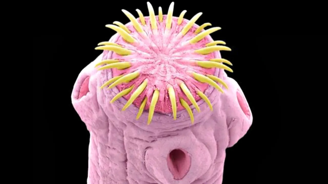 Waspada Kecoak hingga Tungau, 5 Jenis Parasit Ini Bisa Masuk ke Tubuh ...