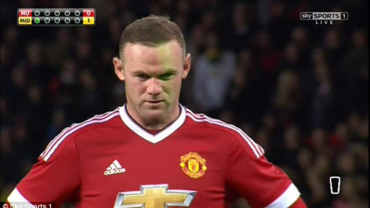 Dapat Serangan Laser, Wayne Rooney Senasib Markus Horison