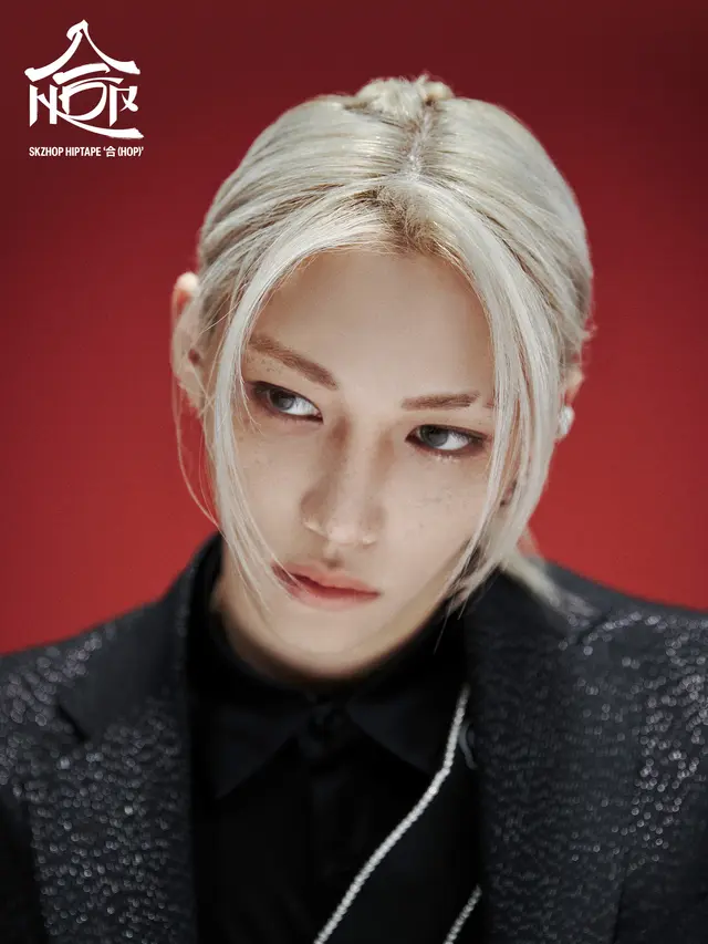 Kronologi Felix Stray Kids Kecelakaan Mobil hingga Alami Patah Tulang ...