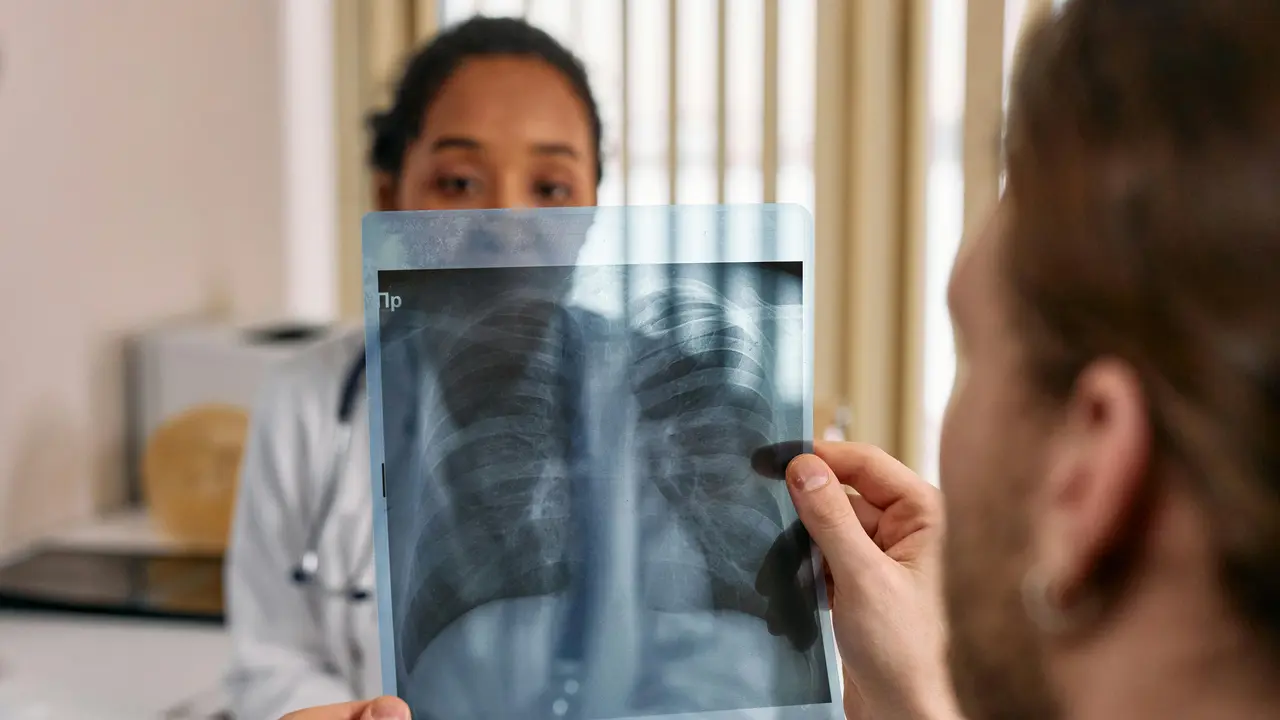 Selain TBC, 13 Macam Penyakit Paru Ini Diam-Diam Ancam Nyawamu - Hot Liputan6.com