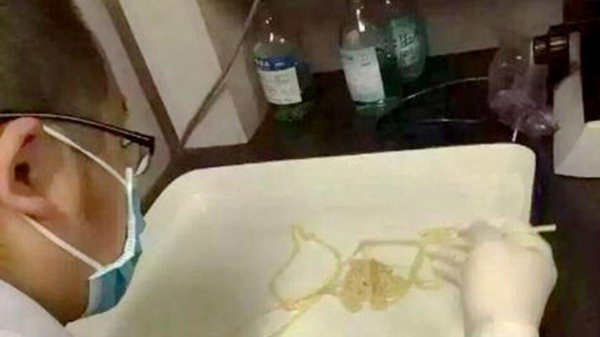 Cacing Pita 4 Meter Ditemukan dalam Perut Pria Pencinta Sashimi ...